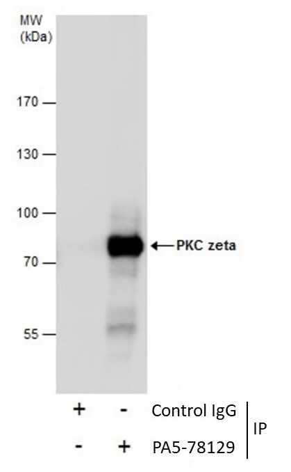 PKC zeta Antibody (PA5-78129)