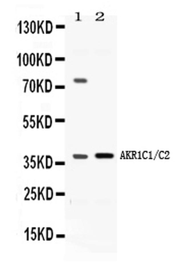 AKR1C1/AKR1C2 Antibody (PA5-78752)