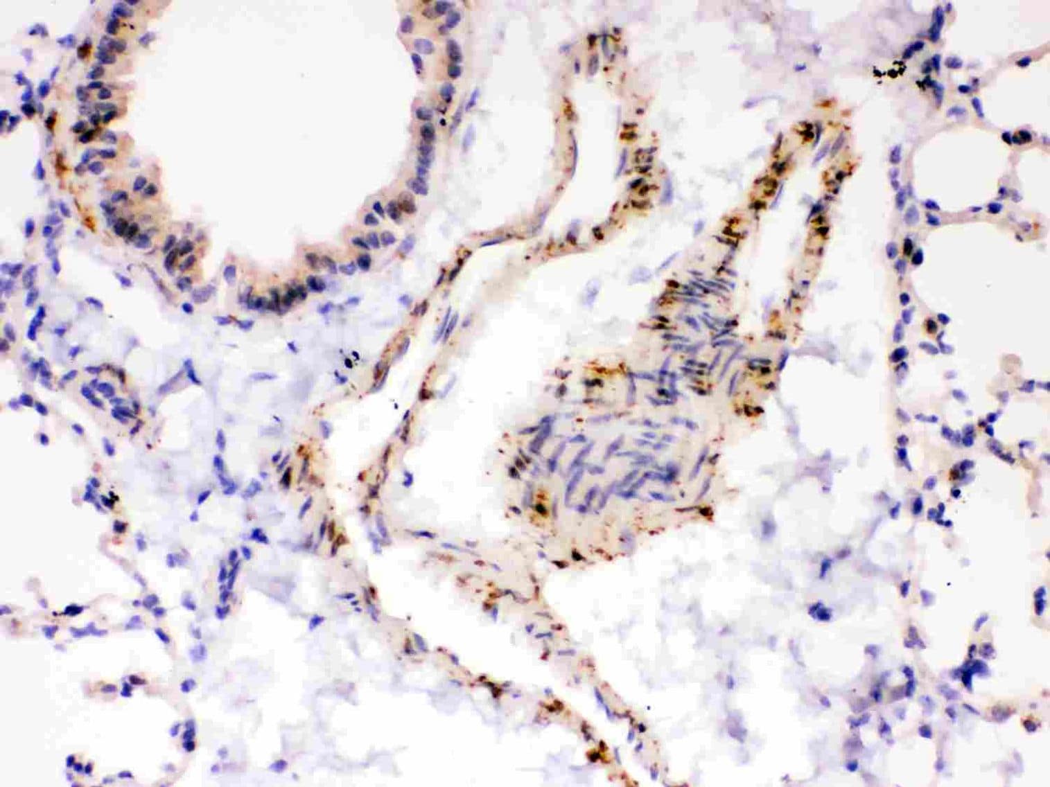 SERCA2 ATPase Antibody (PA5-78837)