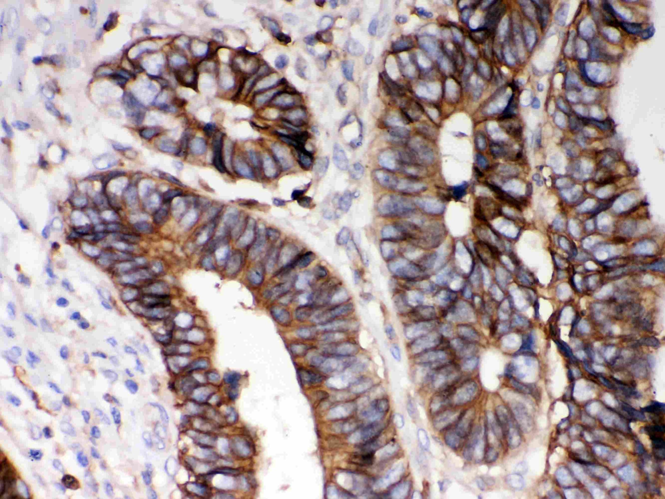 HLA-A Antibody (PA5-79366)