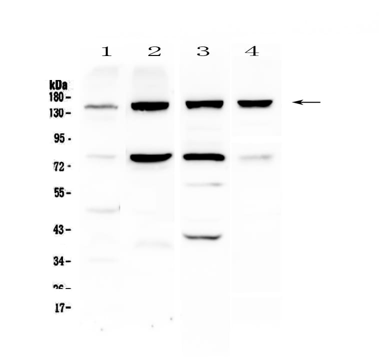 CD49e (Integrin alpha 5) Antibody (PA5-79529)