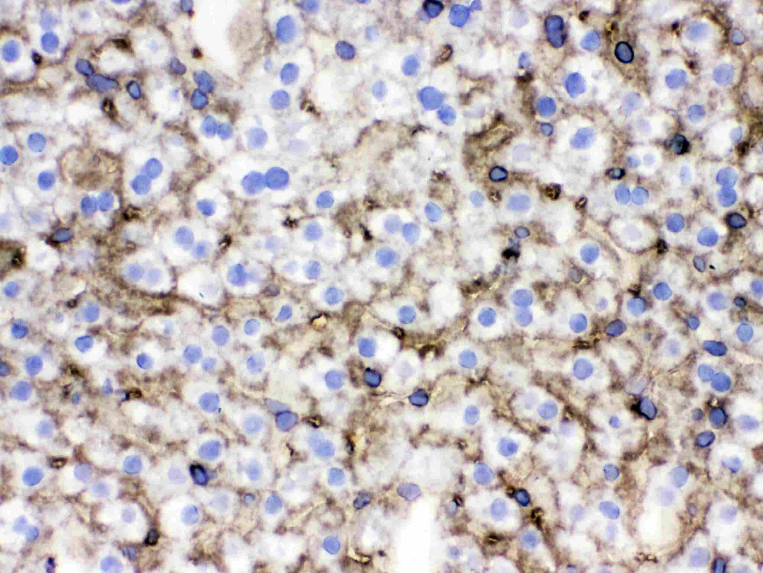 NTCP Antibody (PA5-80001)