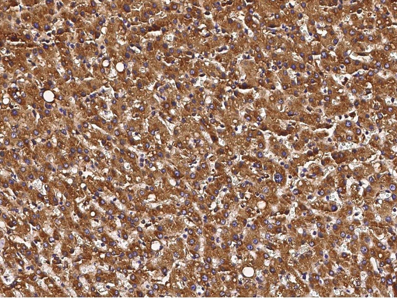 Calreticulin Antibody (PA5-80403)