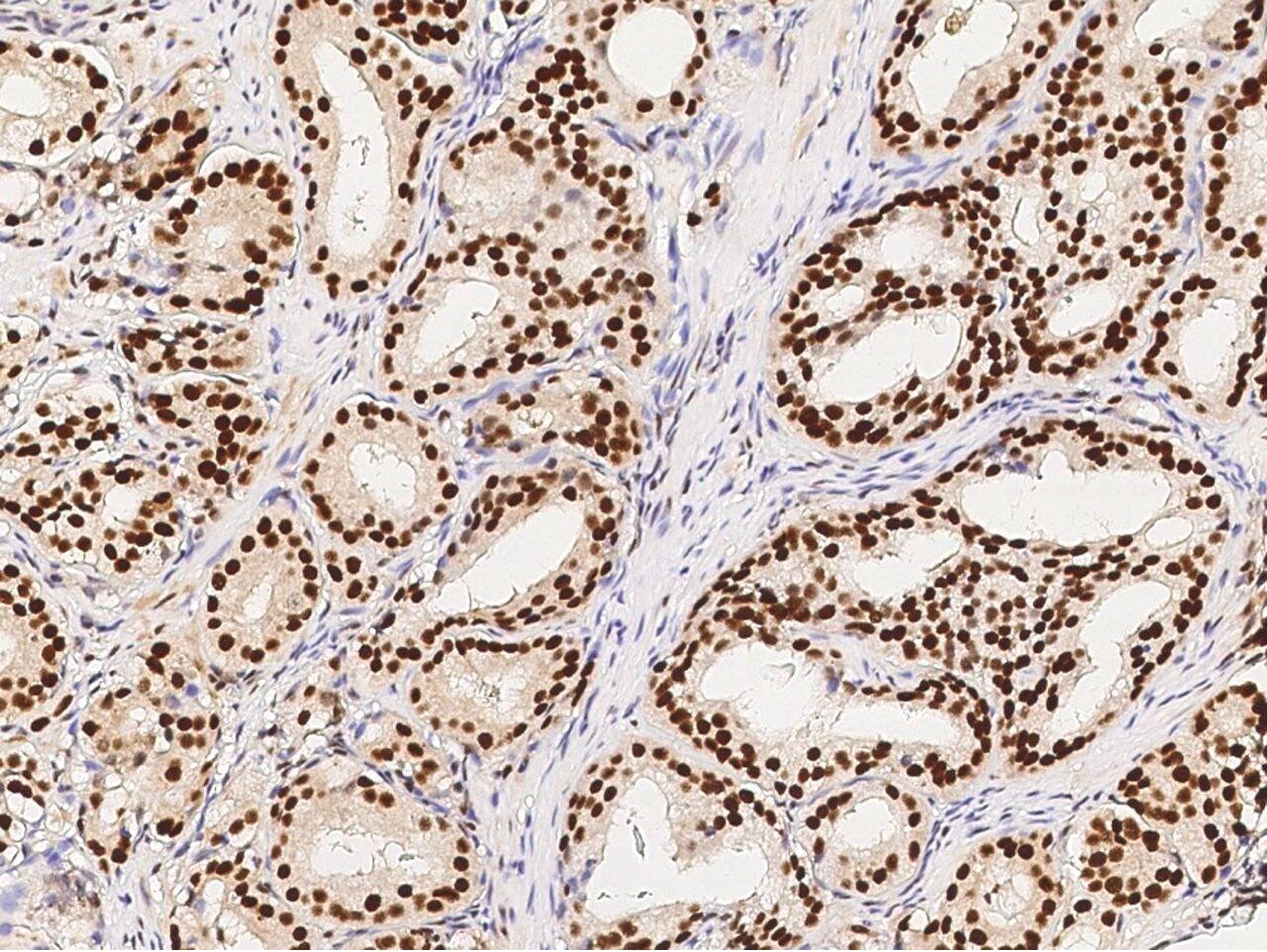 CDK4 Antibody (PA5-80461)