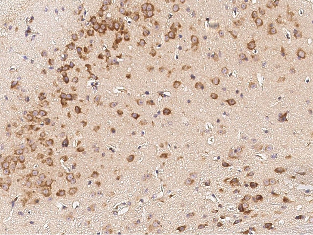 CD45 Antibody (PA5-81304)