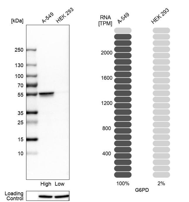 G6PD Antibody (PA5-81897)