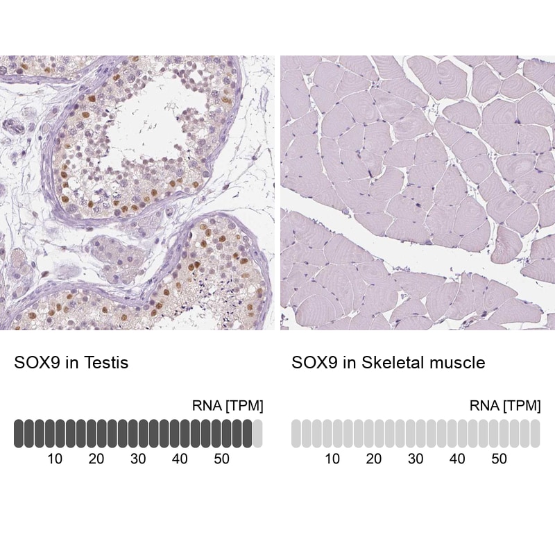 SOX9 Antibody (PA5-81966)