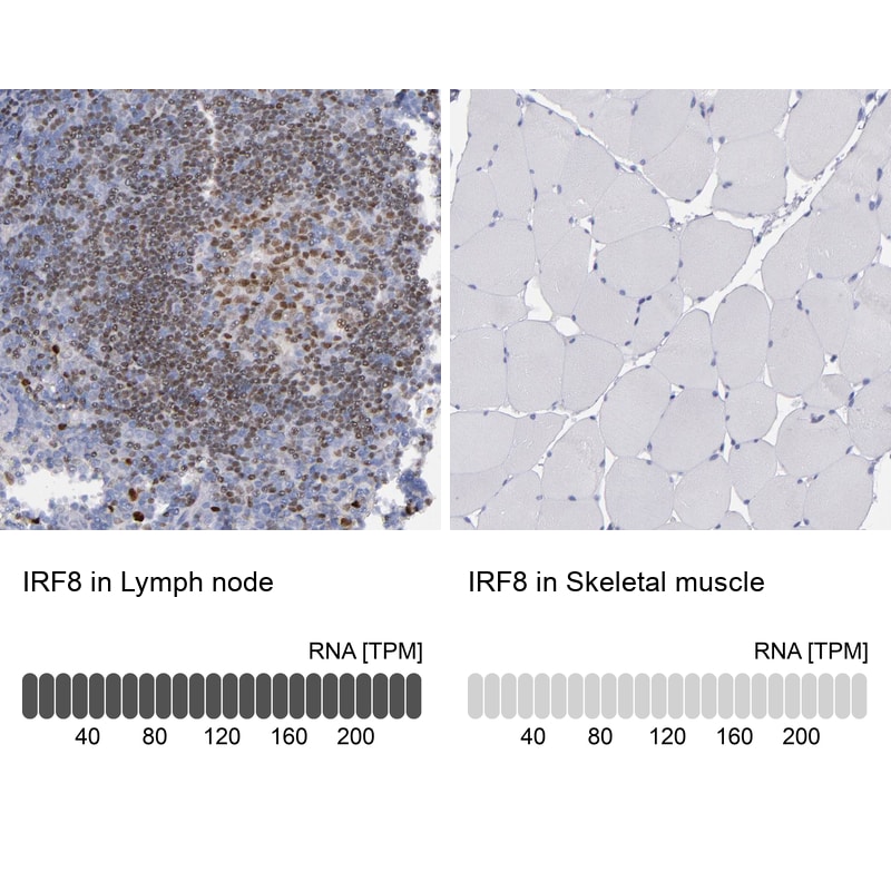 IRF8 Antibody (PA5-82010)