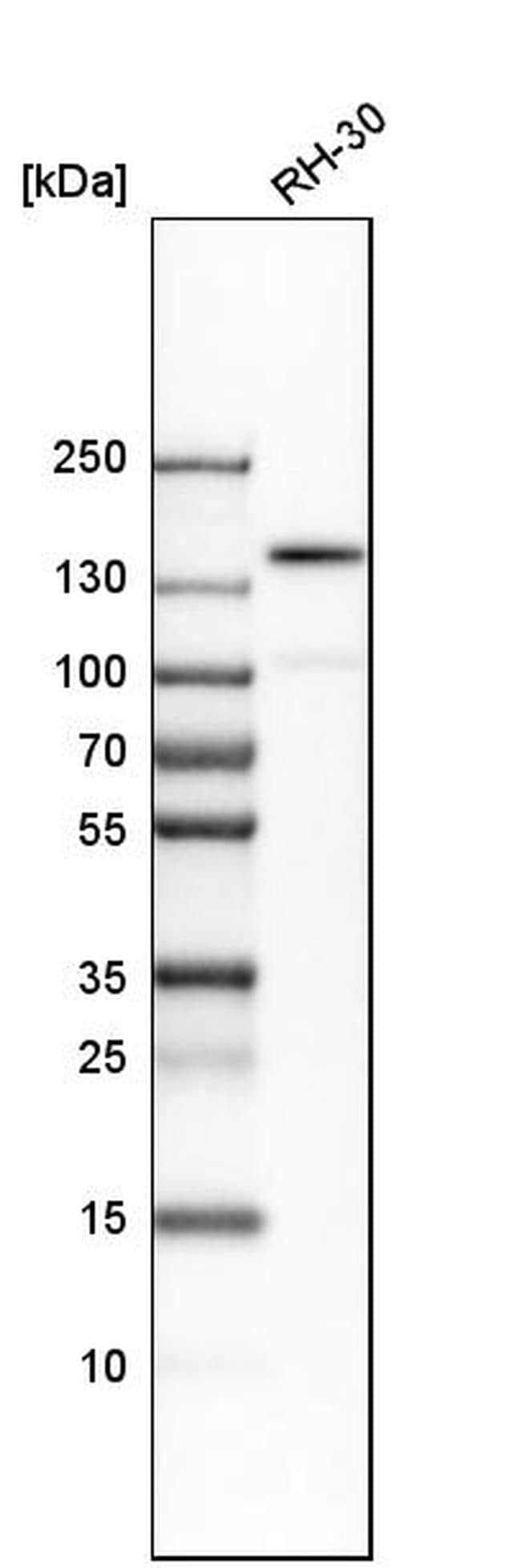 PTK7 Antibody (PA5-82070)