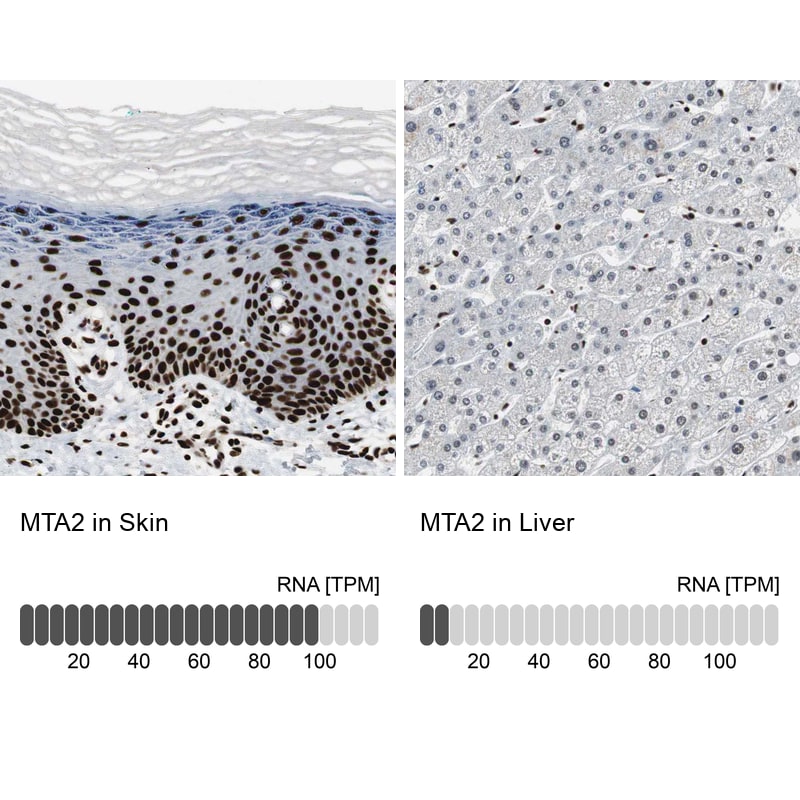 MTA2 Antibody (PA5-82239)