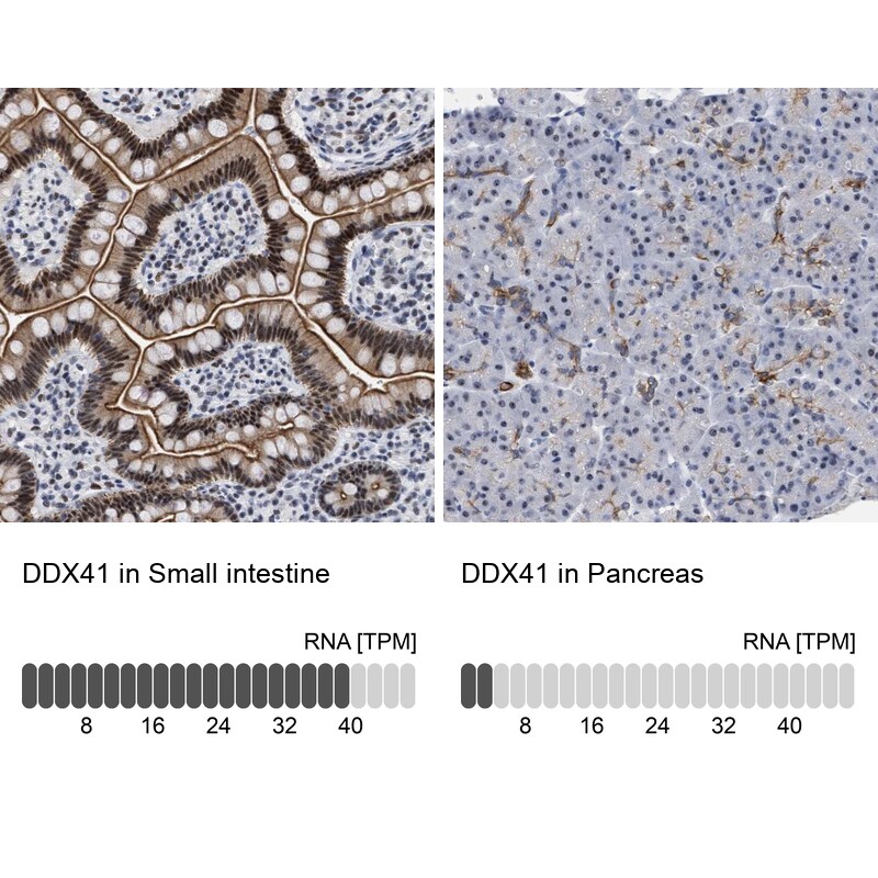 DDX41 Antibody (PA5-82601)