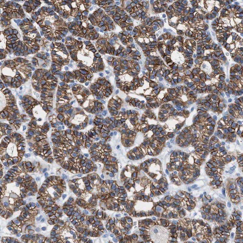 CD98 Antibody (PA5-82611)