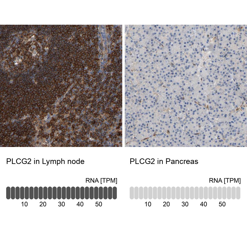 PLCG2 Antibody (PA5-82715)