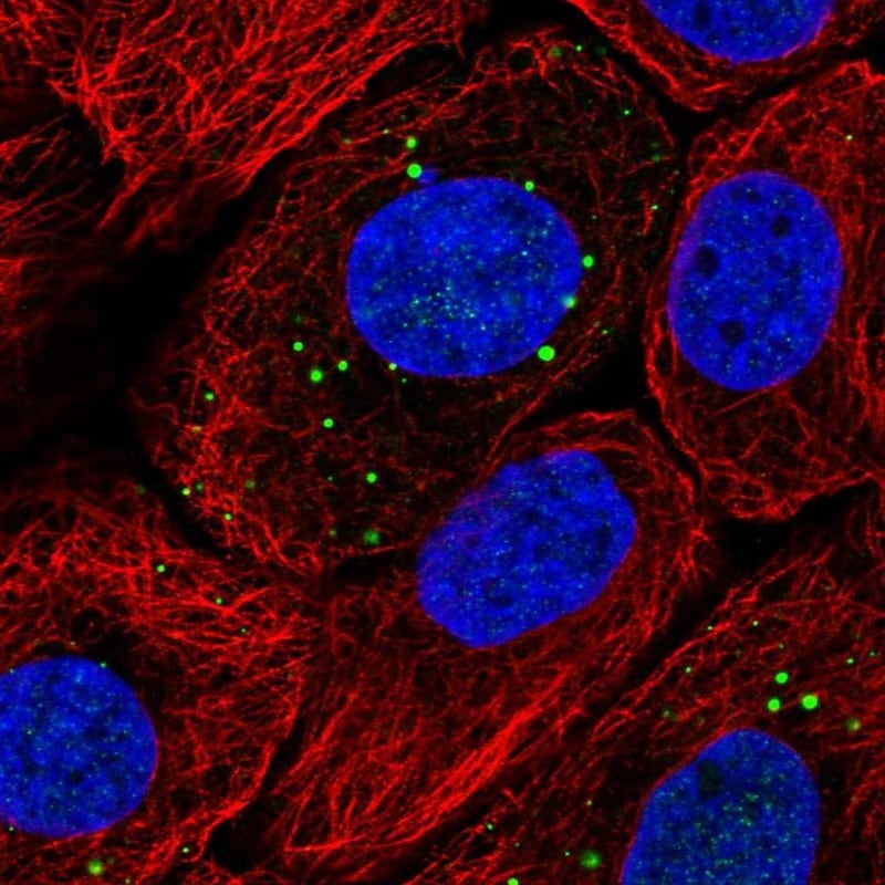 Filaggrin Antibody (PA5-83128)