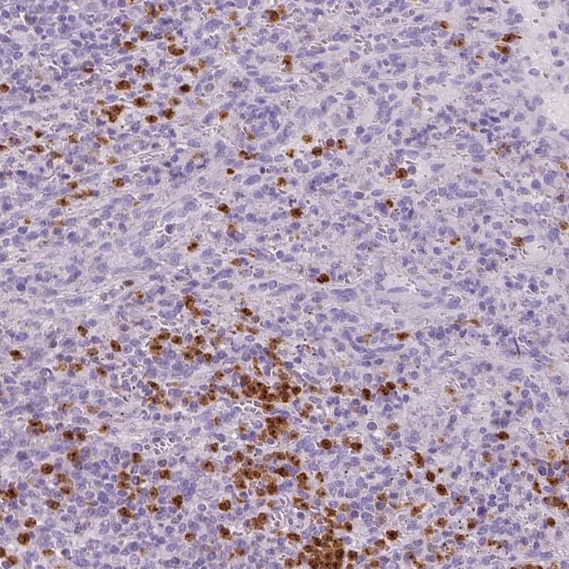 CXCR2 Antibody (PA5-83213)