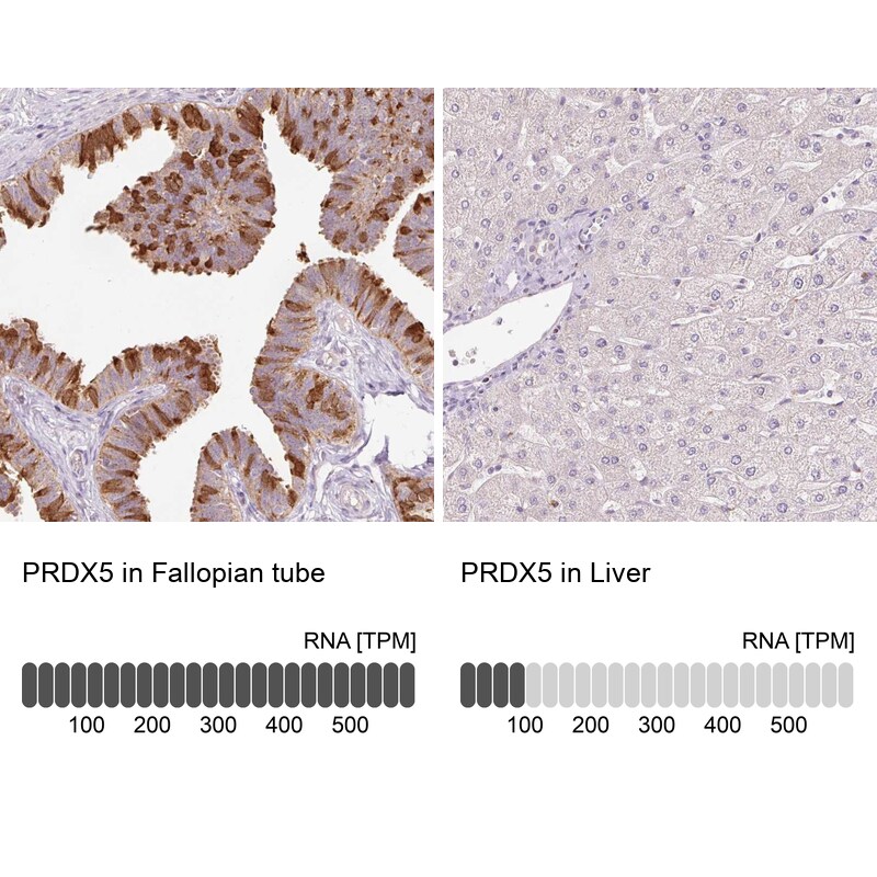 PRDX5 Antibody (PA5-83396)