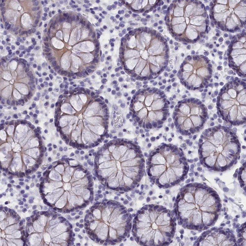 TROP2 Antibody (PA5-83643)