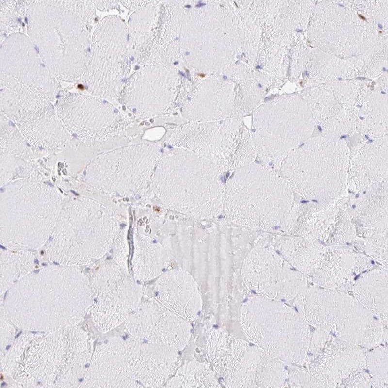 PYCARD Antibody (PA5-83948)