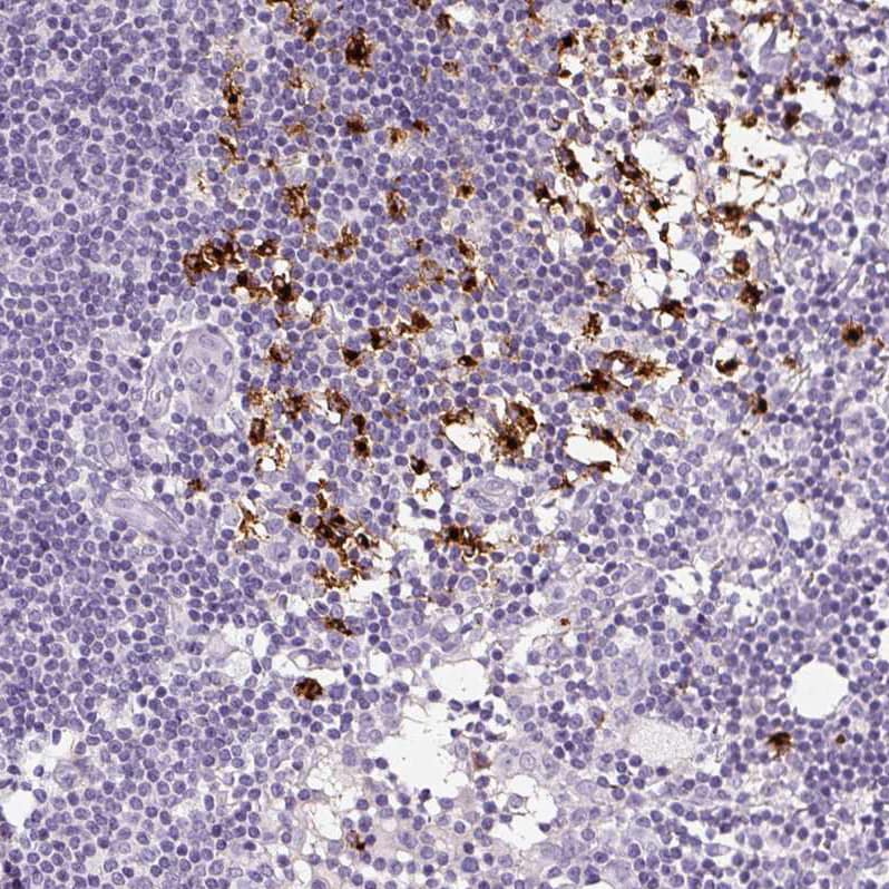 LAMP3 Antibody (PA5-84069)