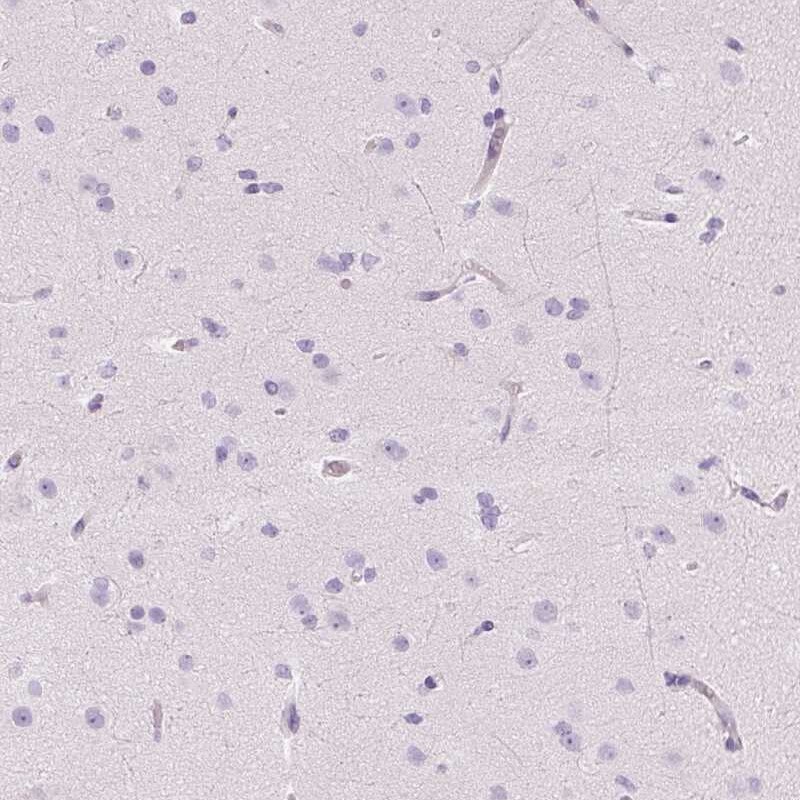 Mast Cell Chymase Antibody (PA5-84117)