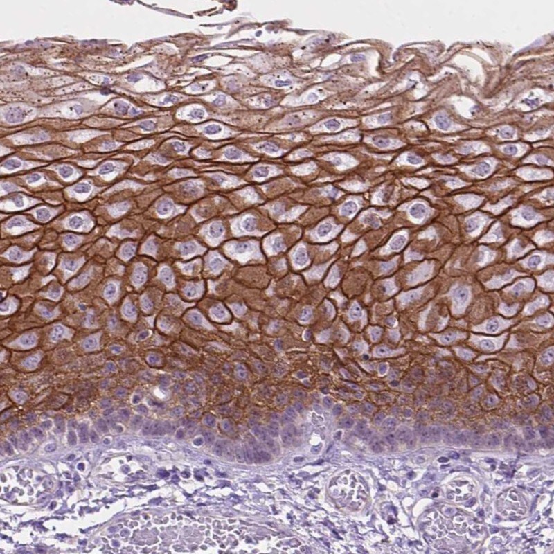 TROP2 Antibody (PA5-84235)