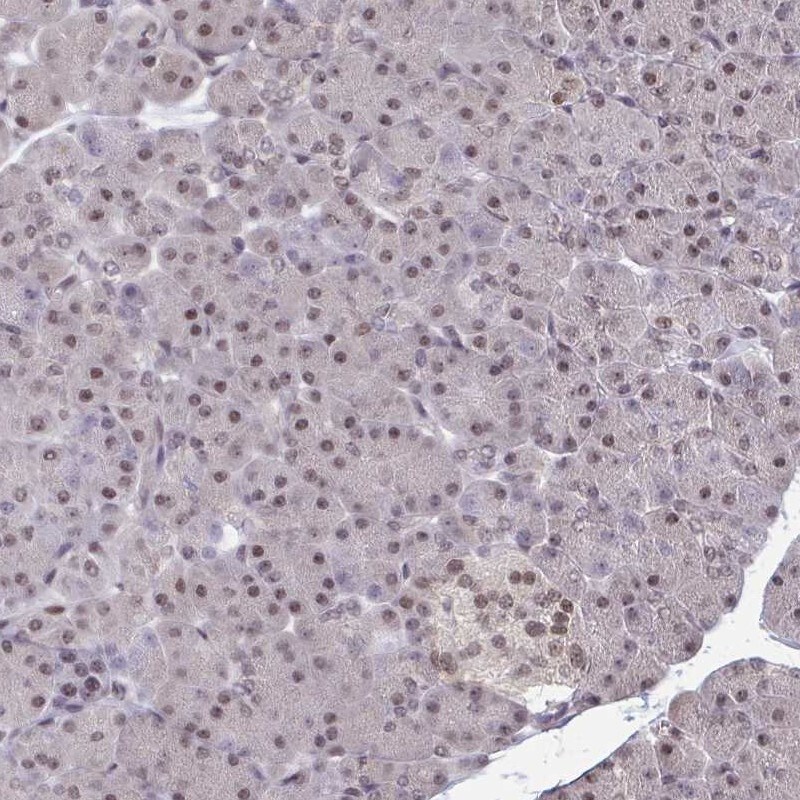 ATF1 Antibody (PA5-84236)