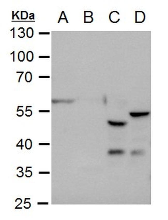 GFAP Antibody (PA5-85109)