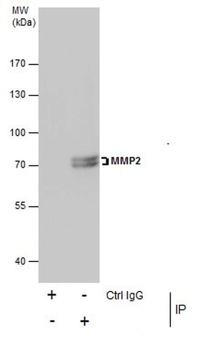 MMP2 Antibody (PA5-85197)