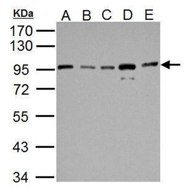 IKK beta Antibody (PA5-85246)