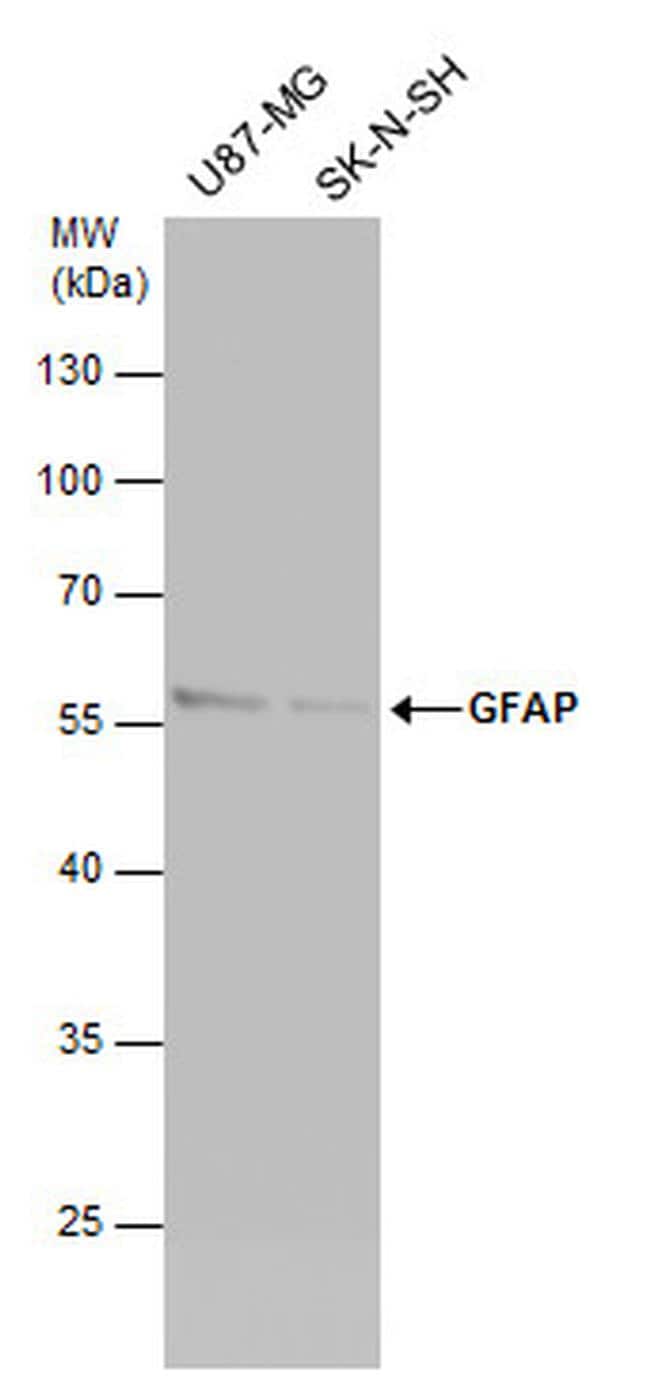 GFAP Antibody (PA5-85261)