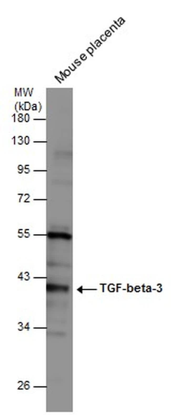 TGF beta-3 Antibody (PA5-85307)