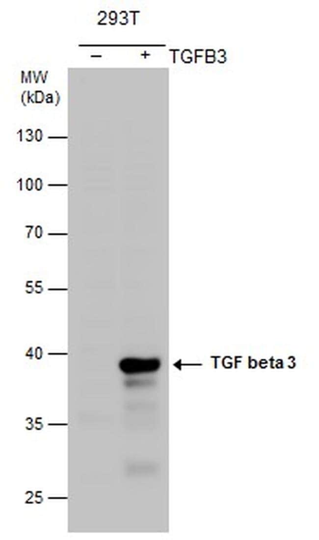 TGF beta-3 Antibody (PA5-85307)