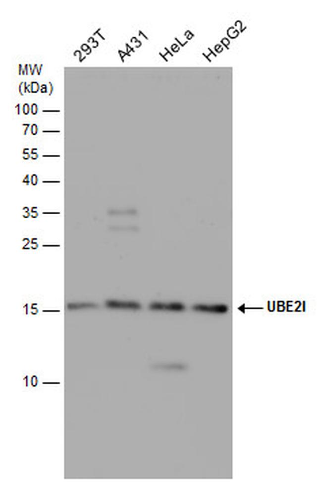 UBC9 Antibody (PA5-85564)