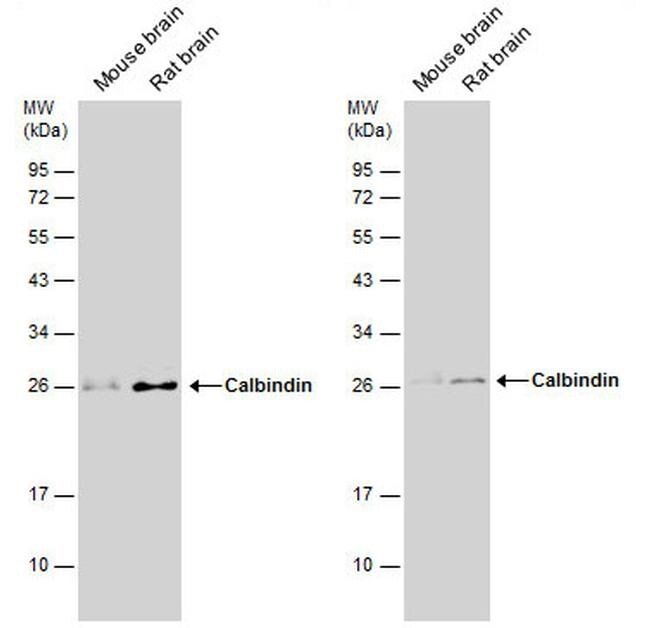 Calbindin D28K Antibody (PA5-85669)