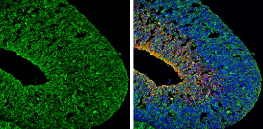 PSD-95 Antibody (PA5-85749)