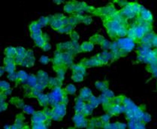 NOX4 Antibody (PA5-86036)