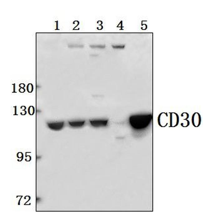 CD30 Antibody (PA5-86095)
