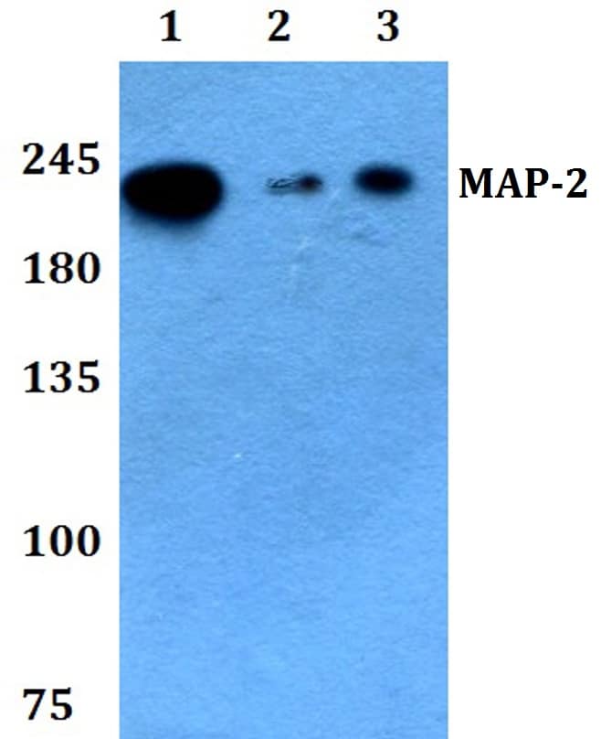 MAP2 Antibody (PA5-86569)