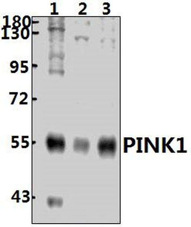 PINK1 Antibody (PA5-86941)