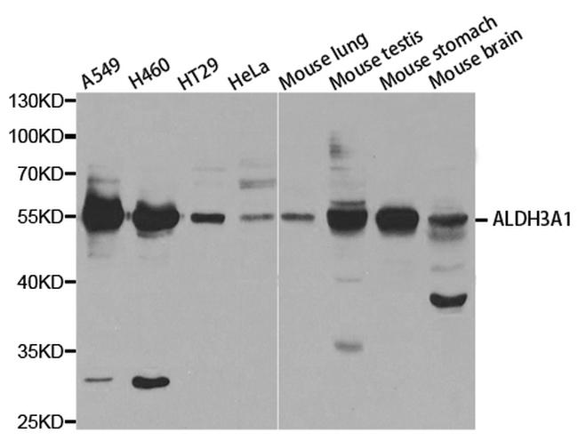 ALDH3A1 Antibody (PA5-87257)