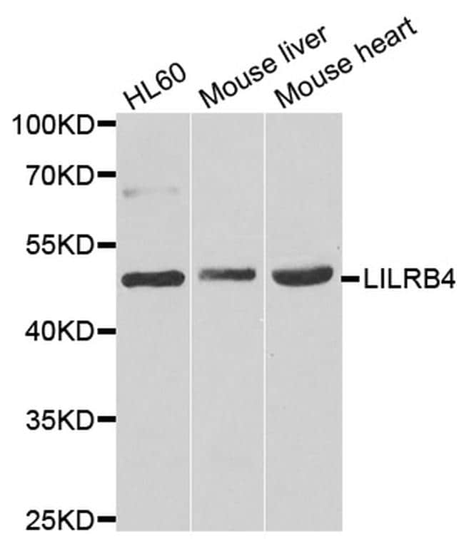 LILRB4 Antibody (PA5-87295)