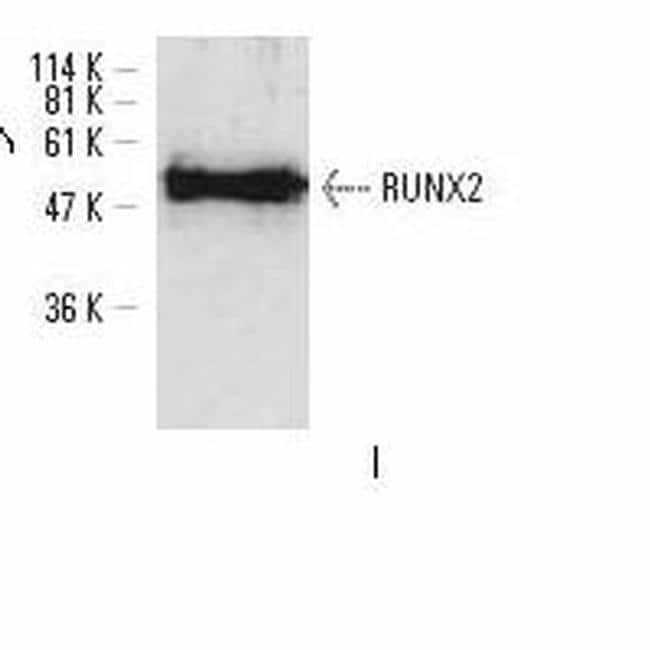 RUNX2 Antibody (PA5-87299)