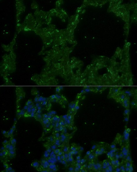 TREM2 Antibody (PA5-87933)