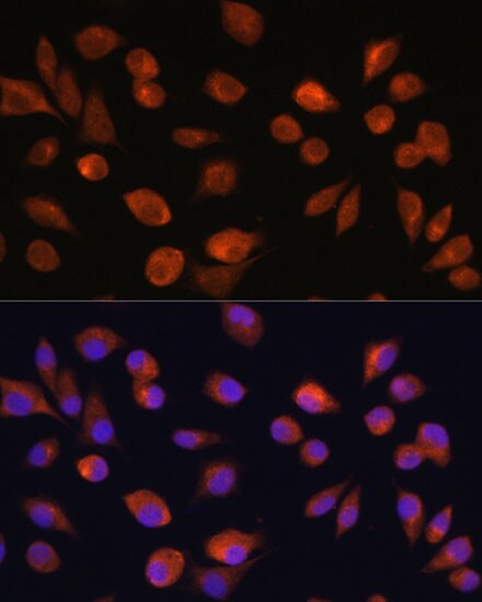 Hopx Antibody (PA5-90538)