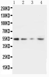 MMP10 Antibody (PA5-94975)