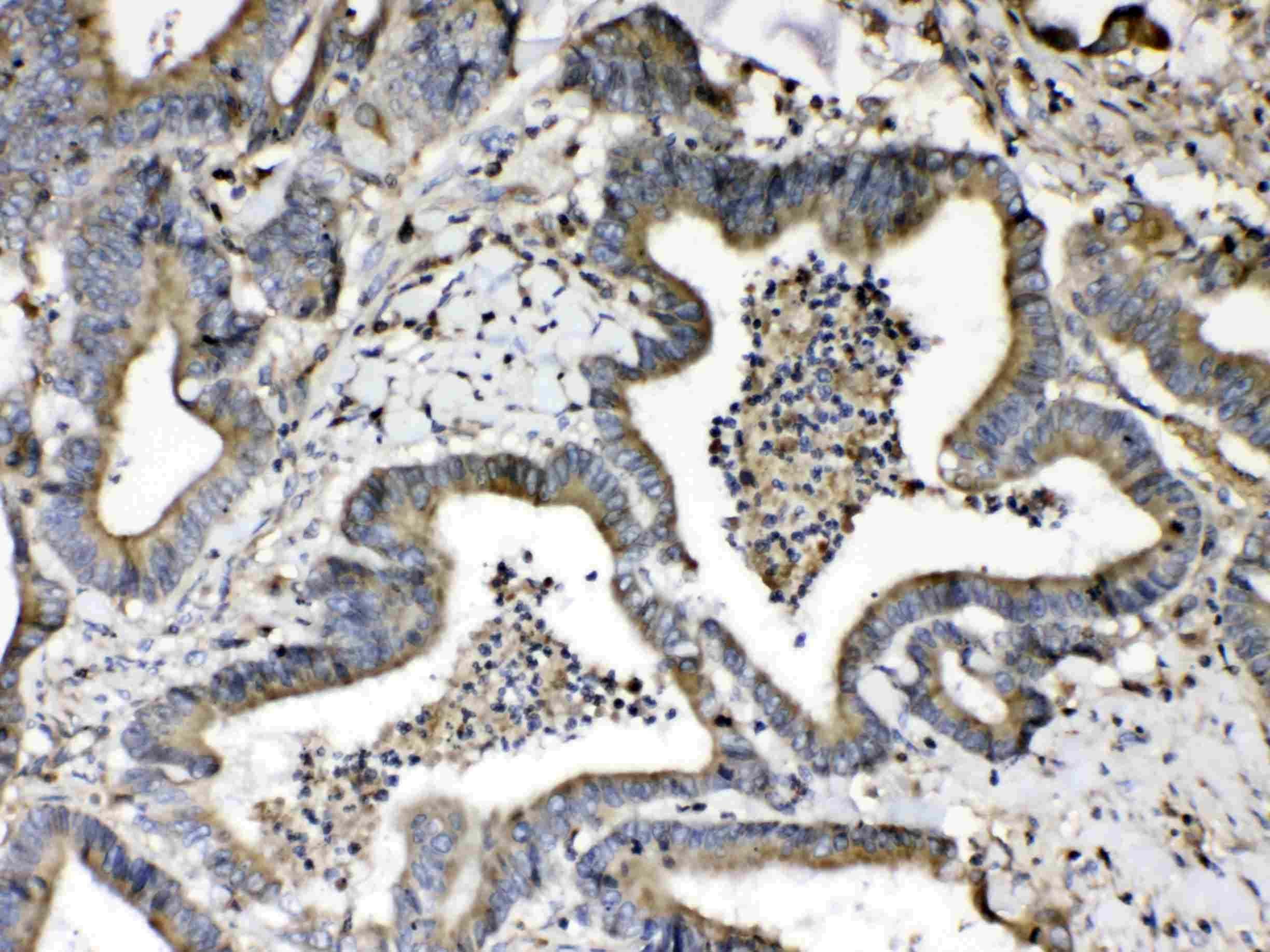 beta-2 Microglobulin Antibody (PA5-95426)