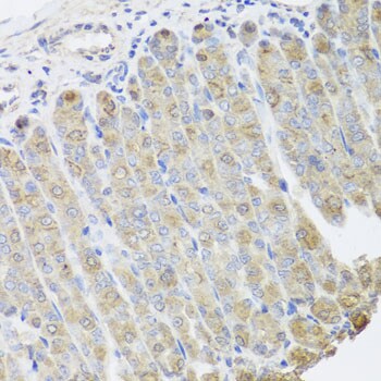 Osteocalcin Antibody (PA5-96529)