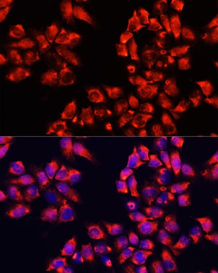 ALDH7A1 Antibody (PA5-97137)
