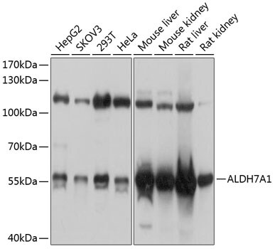 ALDH7A1 Antibody (PA5-97137)