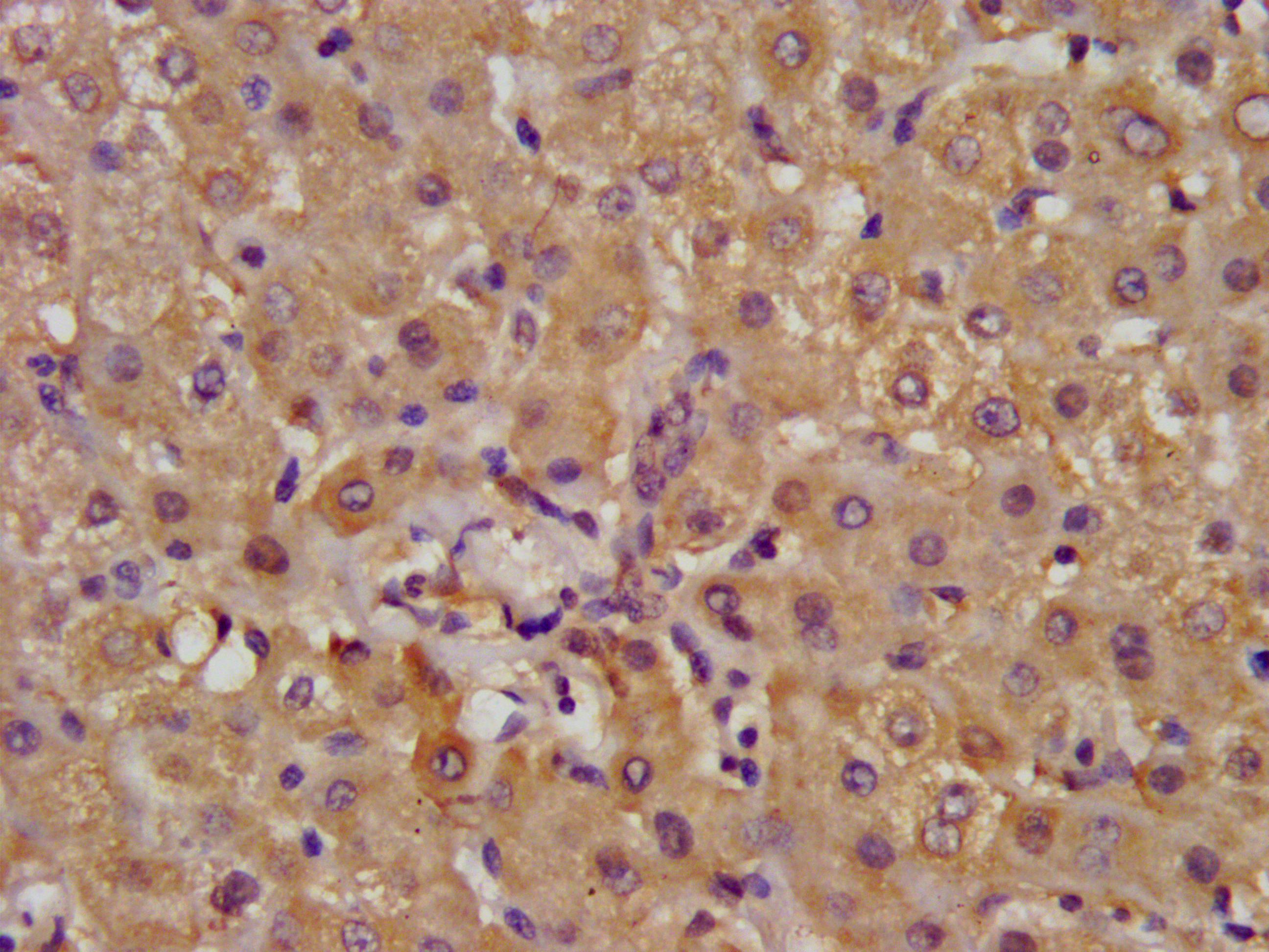 ALDH7A1 Antibody (PA5-97454)